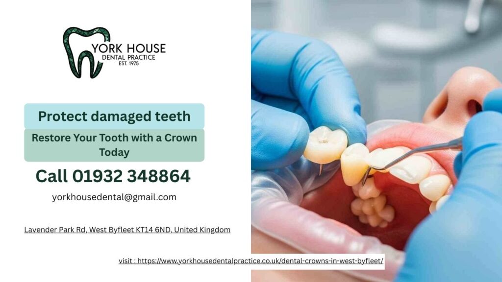 Beautiful Dental Crowns in West Byfleet, Surrey